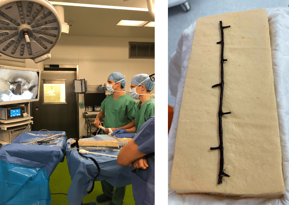Endoscopic Vessel Harvesting Clinical Specialists