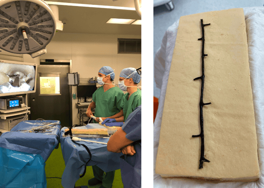 Endoscopic Vessel Harvesting Training and Education
